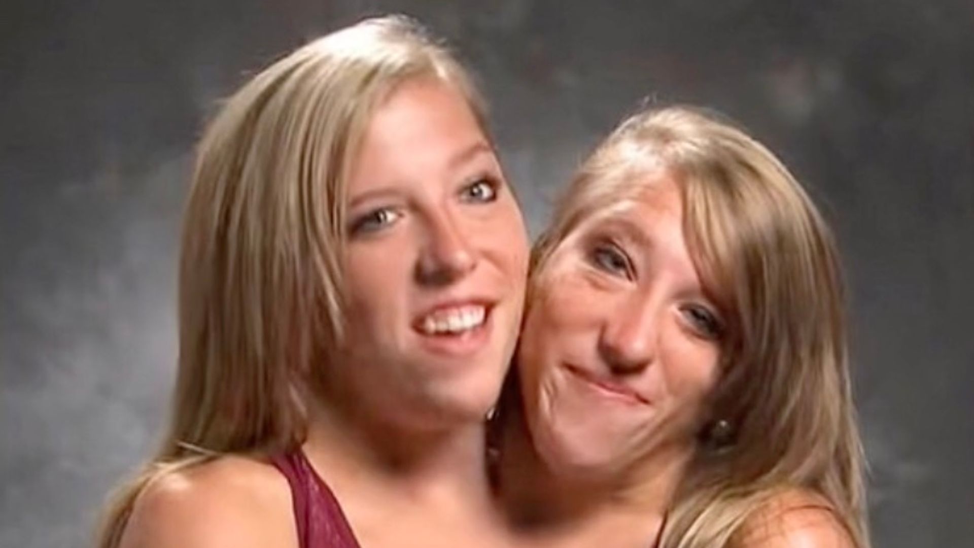 Conjoined twins Abby and Brittany Hensel respond to viral baby photos | HELLO!